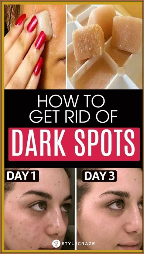 Face Brown Spots Removal The Righ Dark Spots On Skin Brown Spots Removal Dark Spots On Face
