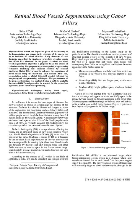 Retinal Angiography Image Segmentation Using Gabor Filters Diaf Top Sellers