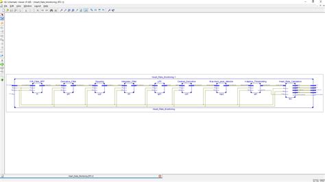 fpga heart rate monitoring pre processing qrs detection stage