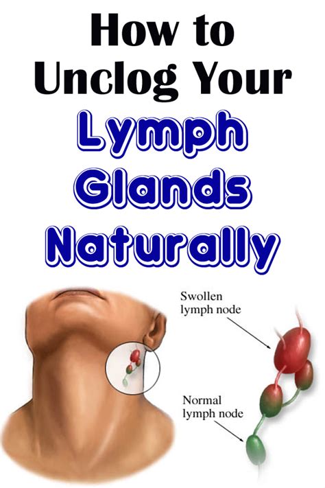 How To Unclog Your Lymph Glands Naturally