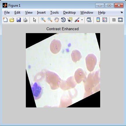 Schematic Diagram Of Dilated CNN And Causal CNN See 5 Download Scientific Diagram