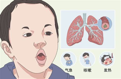 小孩一直咳嗽？注意这几个方面！