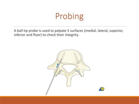 Pedicle Screw Insertion Pptx