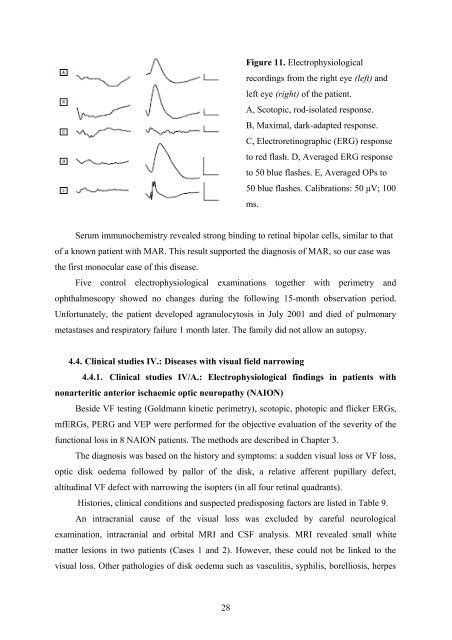 Figure 11 Electrophysiol