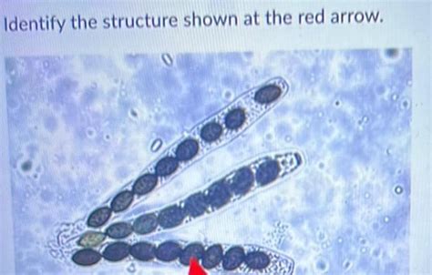 Answered Identify The Structure Shown At The Red Arrow Kunduz