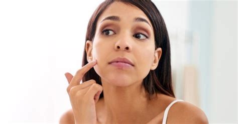 Uh Oh Need To Get Rid Of A Pimple ASAP Tips Straight From Derms Pimples Overnight Pimples