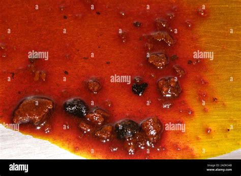 Bile Post Mortem Bile Is A Fluid Produced In The Liver And