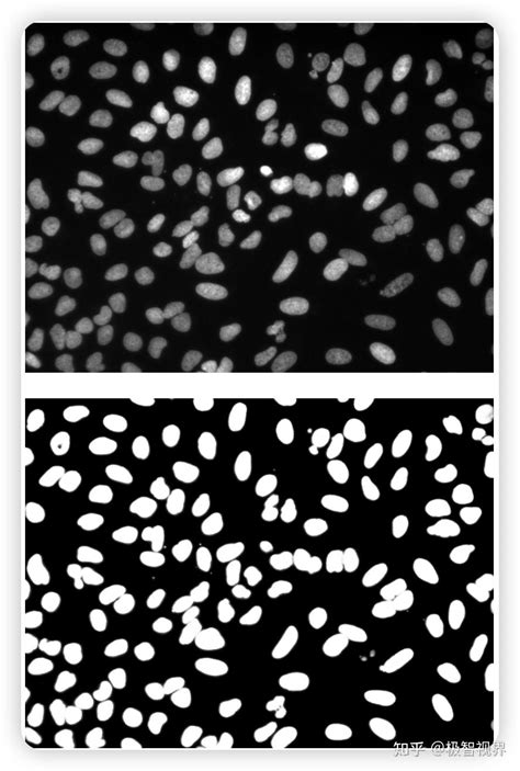 3d分割项目 基于pytorch 3dunet实现的3d体积语义分割算法 知乎