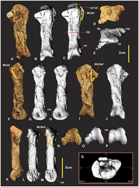 Right Metacarpal Ii Right Metacarpal Ii In Dorsal A B And C Proximal Download Scientific