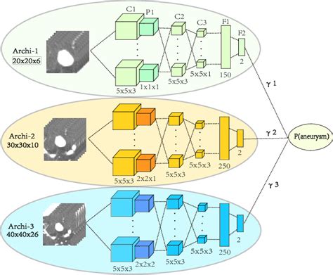Deep Learning Based Detection And Localization Of Cerebal Aneurysms In Computed Tomography