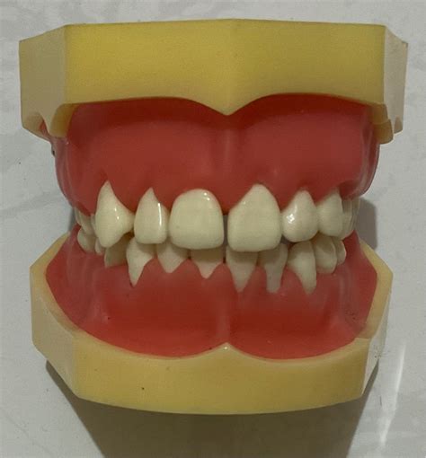 Perio Jaw Model Health And Nutrition Medical Supplies And Tools On Carousell