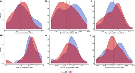 plots for the quality metrics for structural sequences tw1 [upper row