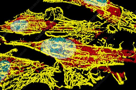 Fibroblast Cells Light Micrograph Stock Image C0624962 Science