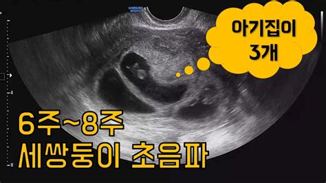 [세쌍둥이 초음파] 6주 8주 Youtube