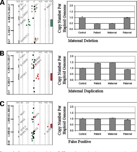 Figure 1 From Genome Wide Oligonucleotide Based Array Comparative Genome Hybridization Analysis