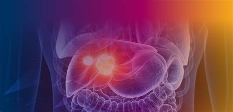 Fda Approves Oncomine Dx Express Test For Tumor Profiling And As