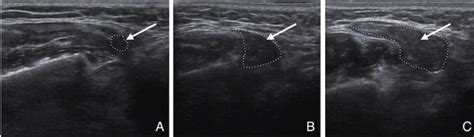 Examples Of BFP Size Variability A Small B Medium C Big Download Scientific Diagram