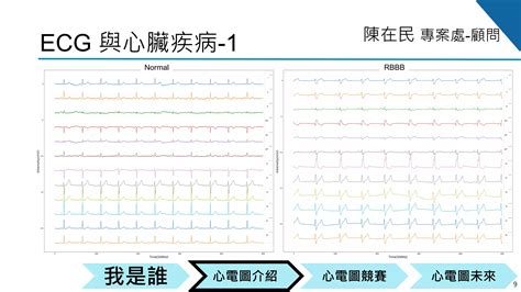 Ecg Signal Processing For Heart Diseases Detection Pdf