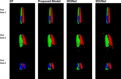 segmentation results proposed depth wise multilevel deep network vs download scientific diagram
