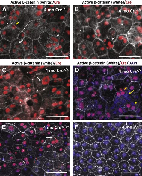 Nuclear Rpe Abnormalities Increase In Homozygous Vmd2 Cre Cre þ þ