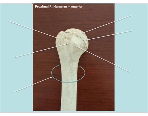R Humerus Quiz