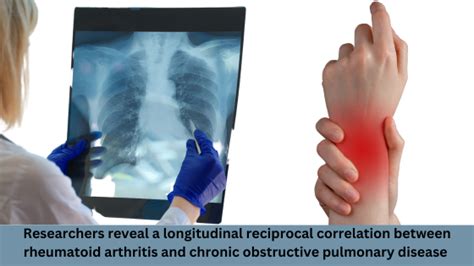 Researchers Reveal A Longitudinal Reciprocal Correlation Between