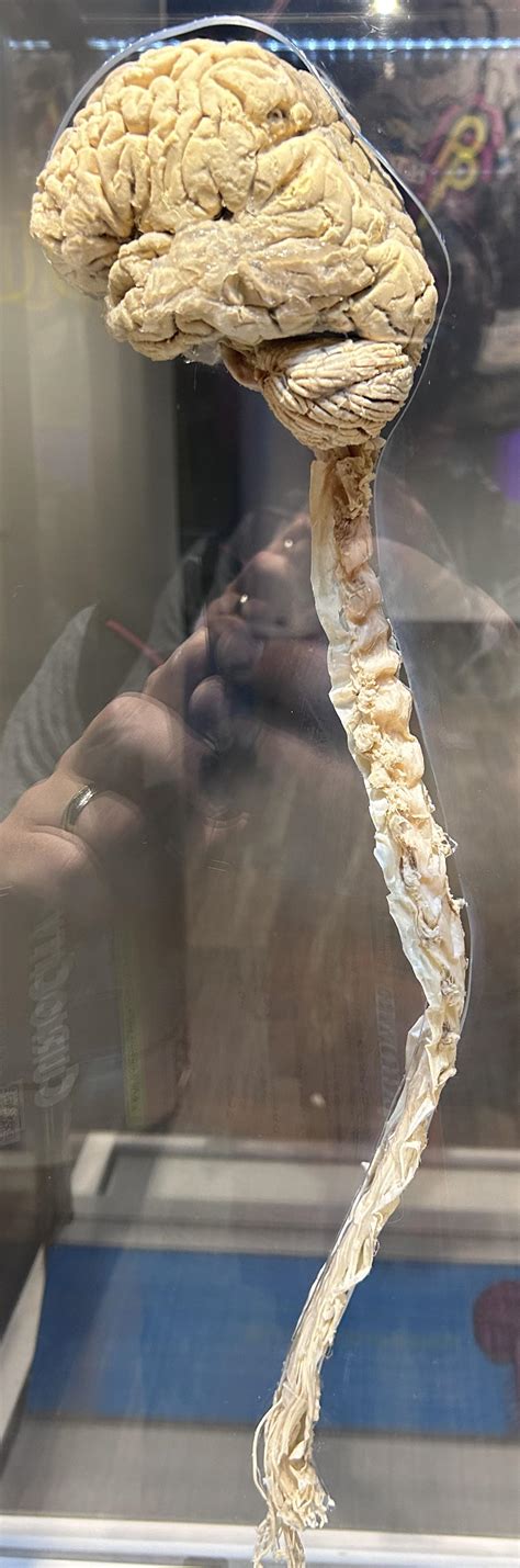 Real Human Brain And Spinal Cord