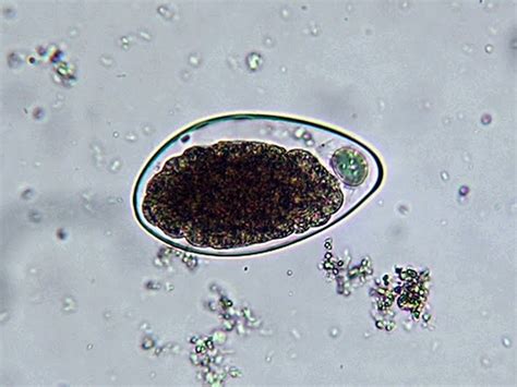 Fun With Microbiology Whats Buggin You Hookworm And Trichostrongylus Ova