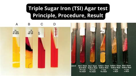 Of Oxidation Fermentation Test Principle Purpose Procedure