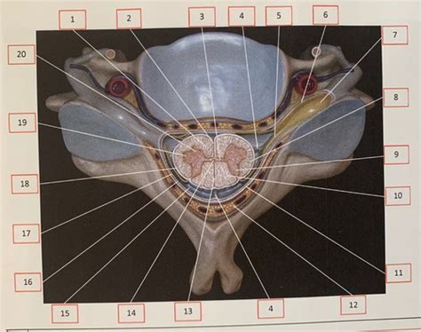 Lab VII Prelab Flashcards Quizlet