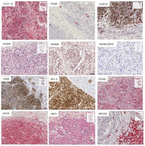 Immunohistochemistry Ihc Results Showing The Staining Pattern And Download Scientific Diagram