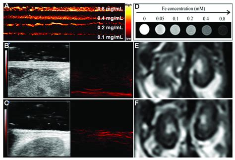 Photoacousticmagnetic Resonance Dual Mode Imaging A Photoacoustic