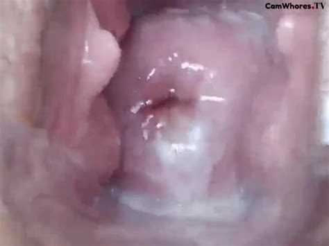 Speculum And Cervix View