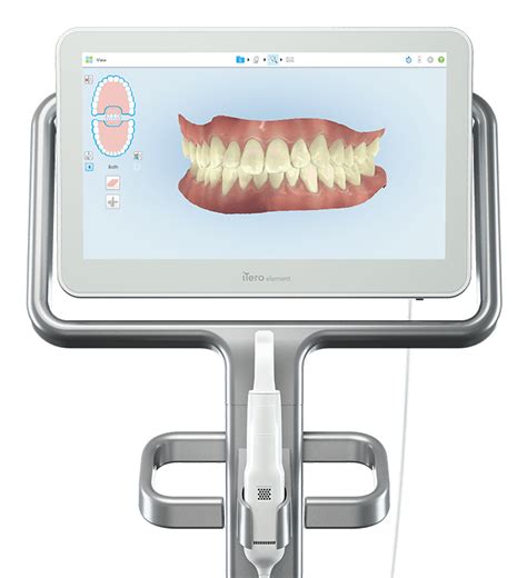 ITero Element Scanner Dentist In Temecula CA