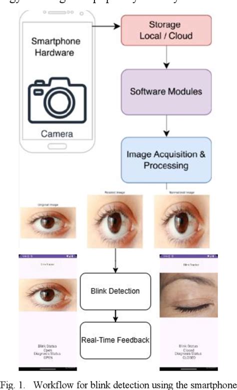 Figure 1 From Real Time Eye State Detection Using Deep Learning For Blink And Dry Eye Diagnosis