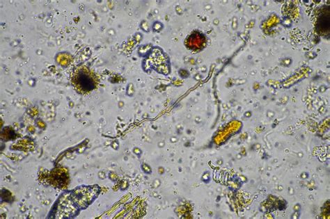 農場を形成する生きた土壌を示す土壌サンプル中の真菌の菌糸と土壌菌 プレミアム写真
