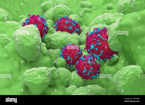 Non Small Cell Lung Cancer Nsclc In The Lung Tissue Super Closeup View 3d Illustration Stock