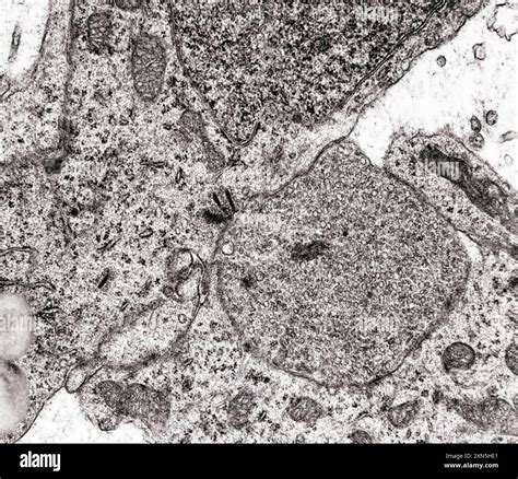 Transmission Electron Micrograph Tem Of Ribbon Synapses Showing