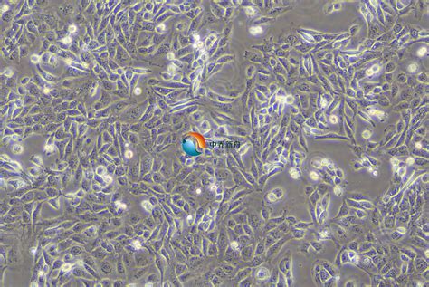 Id8 Luc细胞 示踪细胞 小鼠卵巢上皮癌细胞 荧光素酶标记 中乔新舟生物科技有限公司