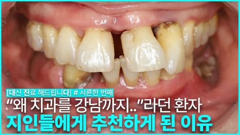 대진다 너무 불편하신 나머지 전라남도 광주에서 서울까지 내원해 주신 환자분│당일 임플란트 임플란트 뼈이식 임시치아│서른한 번째 Youtube