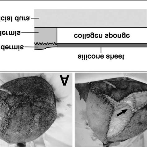 Case 1 Macroscopic Views And Schematic Drawing Of Skinplasty With Download Scientific Diagram