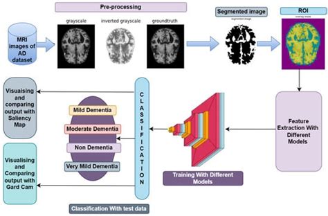 An Explainable Ai Paradigm For Alzheimers Diagnosis Using Deep Transfer Learning