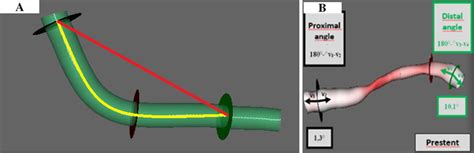 Calculation Of The Arc Chord Ratio A And Edge Bending Angles B The Download Scientific