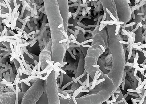 Pseudomonas And Pythium Greeting Card By Dennis Kunkel Microscopy