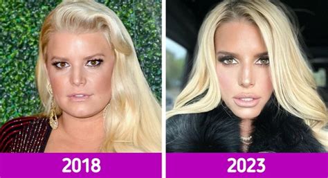 ۷ کار عجیبی که سلبریتی های هالیوودی برای حفظ جوانی خود انجام می دهند