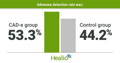 Artificial Intelligence Increases Adenoma Detection In CRC Screening