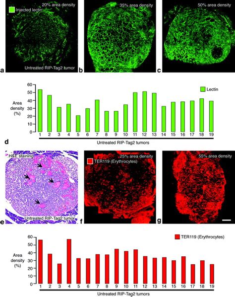Individual Variability Of Densities For Perfused Vessels Lectin Download Scientific Diagram