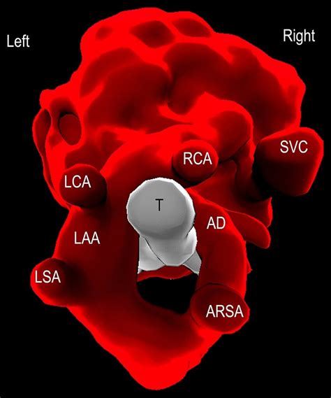 Fetal Cardiac Mri Performed At 30 3 Weeks Of Gestation 3d Download Scientific Diagram