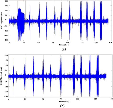 A Semg With Electrical High Frequency Interference “red Line Represents Download Scientific