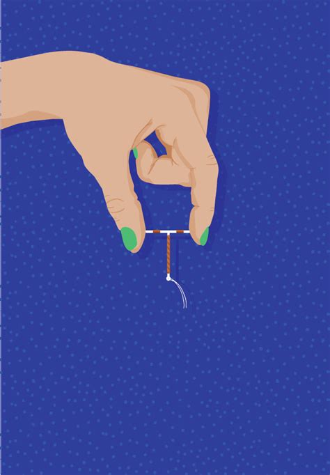 Non Hormonal Iuds My Wordpress